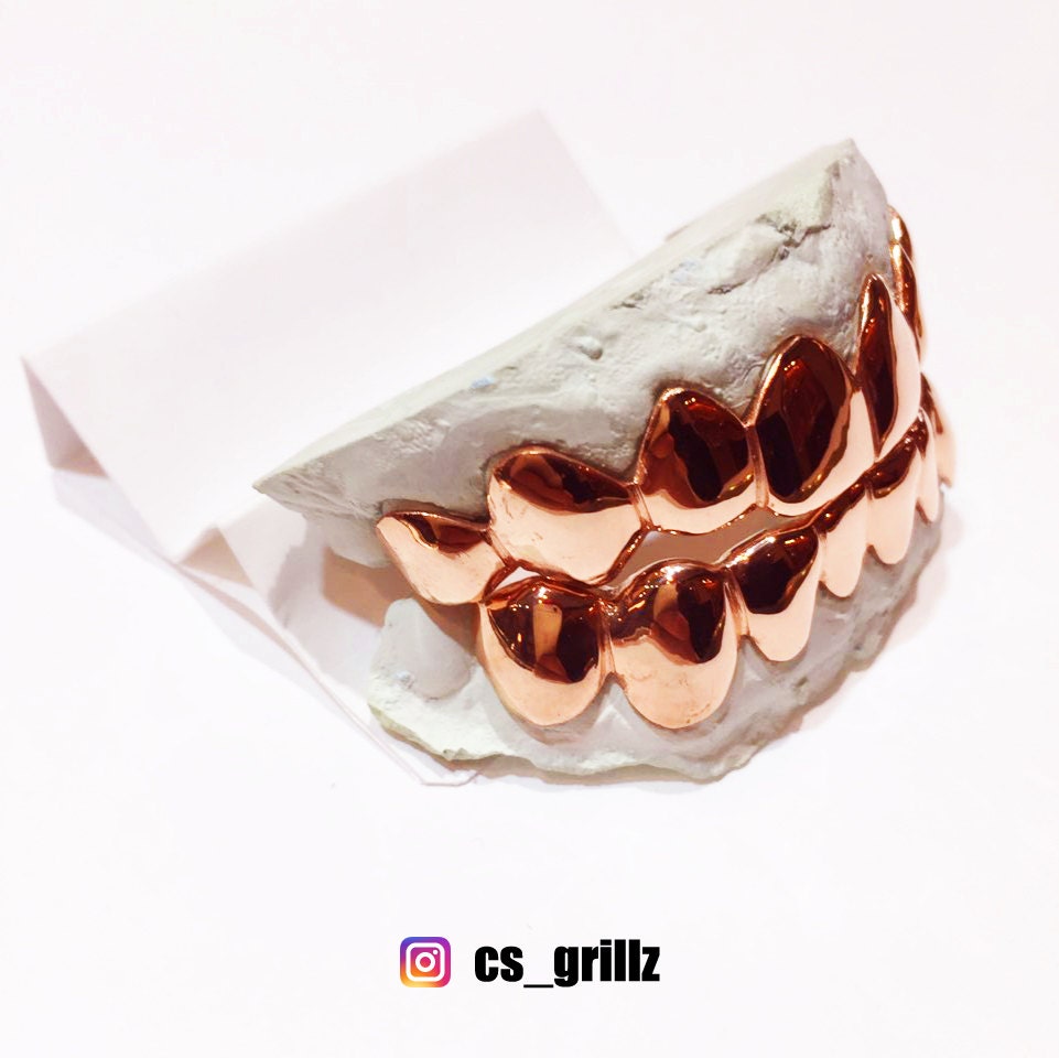 14K Solid Rose Gold Custom Fit REAL Grill Gold Teeth Handmade GRILLZ.