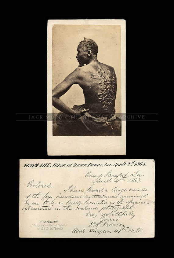 RESERVED / Do Not Buy // 1863 CDV of Escaped Slave Gordon