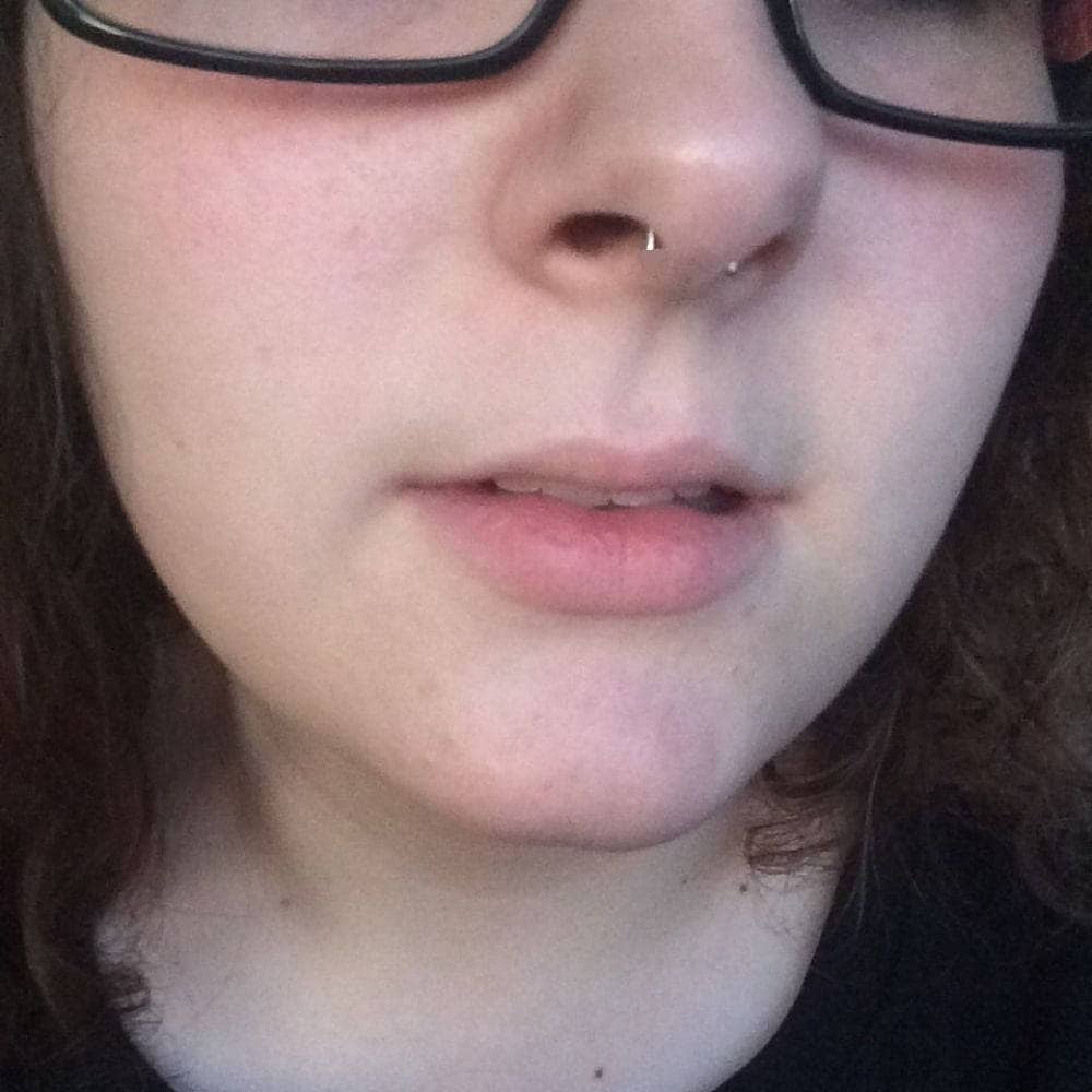 Septum Retainer